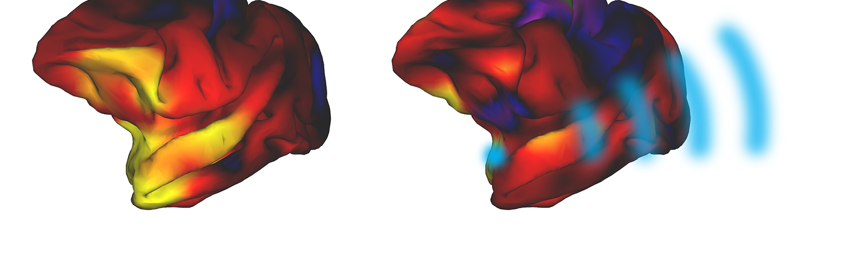 Focused Ultrasound Neuromodulation | Focused Ultrasound Neuromodulation